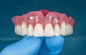 General And Cosmetic Dentistry In Catford | Maxident Clinic