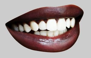 General And Cosmetic Dentistry In Catford | Maxident Clinic